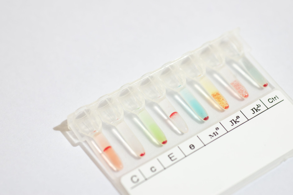 Gel-Cards - Life Science - Solutions - Rychiger