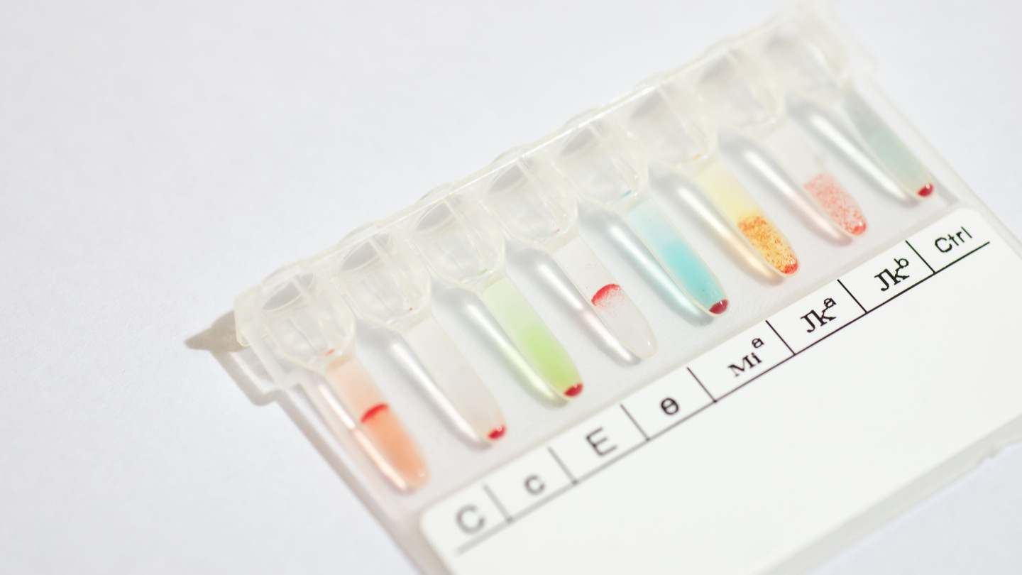 Gel-Cards - Life Science - Solutions - Rychiger